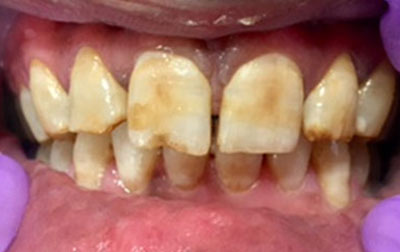 Best Dental Clinic In Delhi & Dentist In South Delhi, India