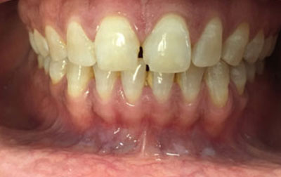 Best Dental Clinic In Delhi & Dentist In South Delhi, India